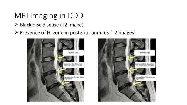 Low back pain differential diagnosis and treatment | PPTX