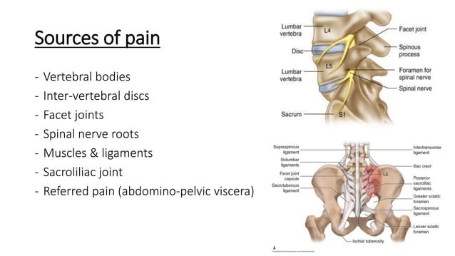 Low back pain differential diagnosis and treatment | PPTX