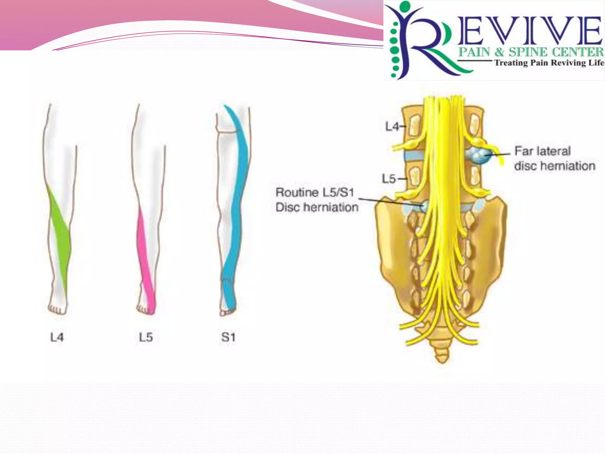 Lbp differentials | PPTX