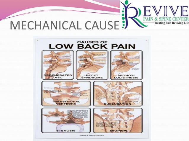 Lbp differentials | PPTX | Physical Therapy | Wellness