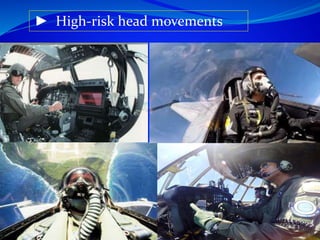 LBP & Neck Pain in Aviation | PPTX