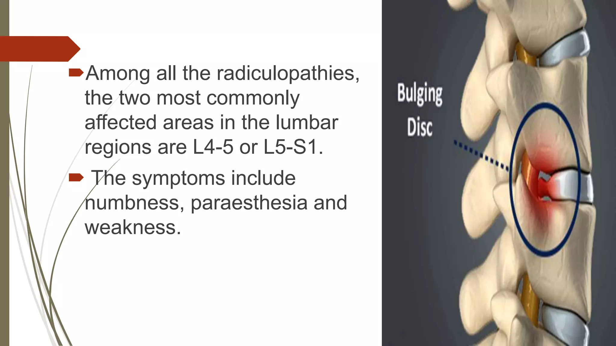 low back pain with radiating lower limb | PPTX | Physical Therapy ...