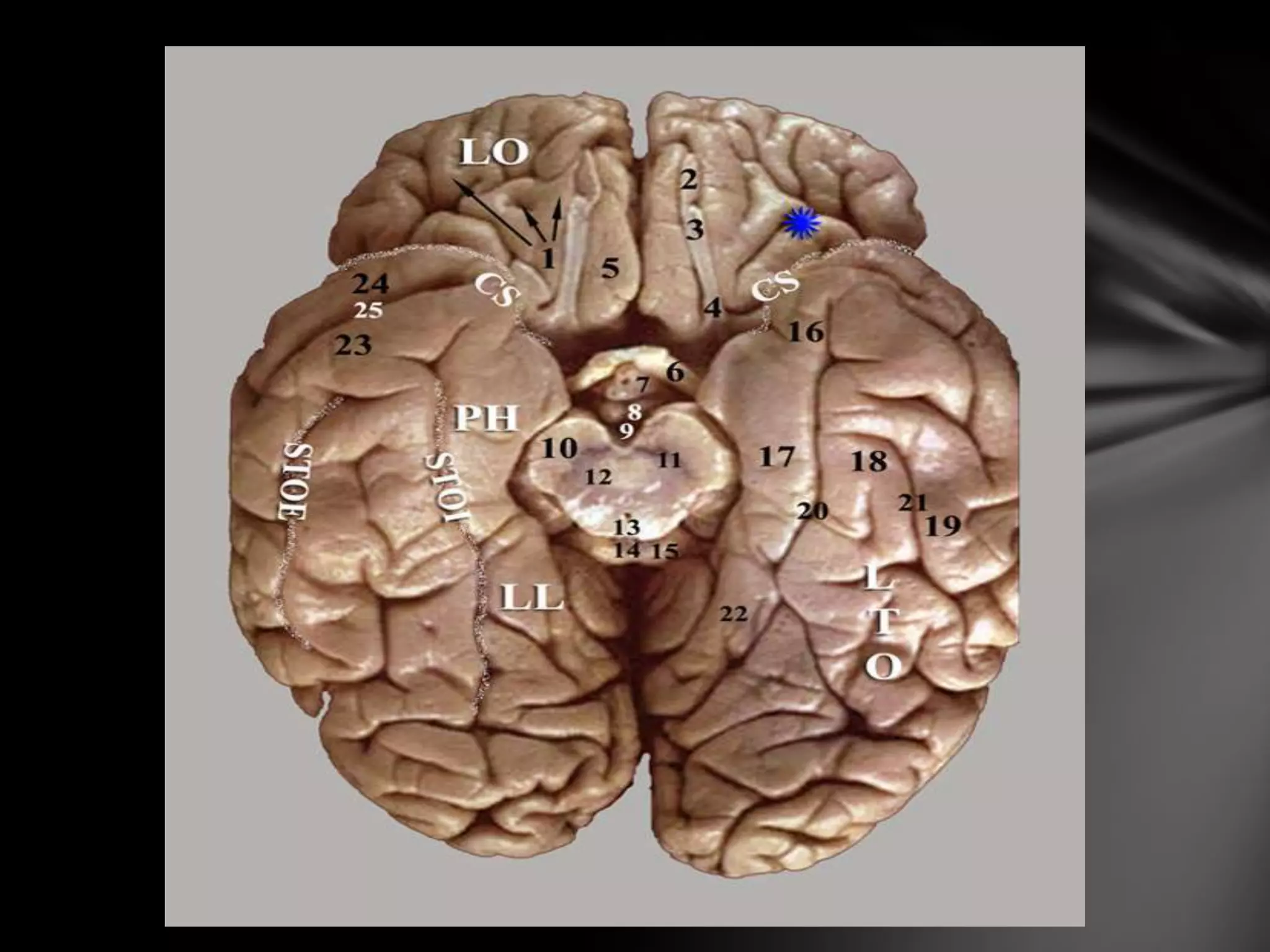 Lóbulo temporal anatomia