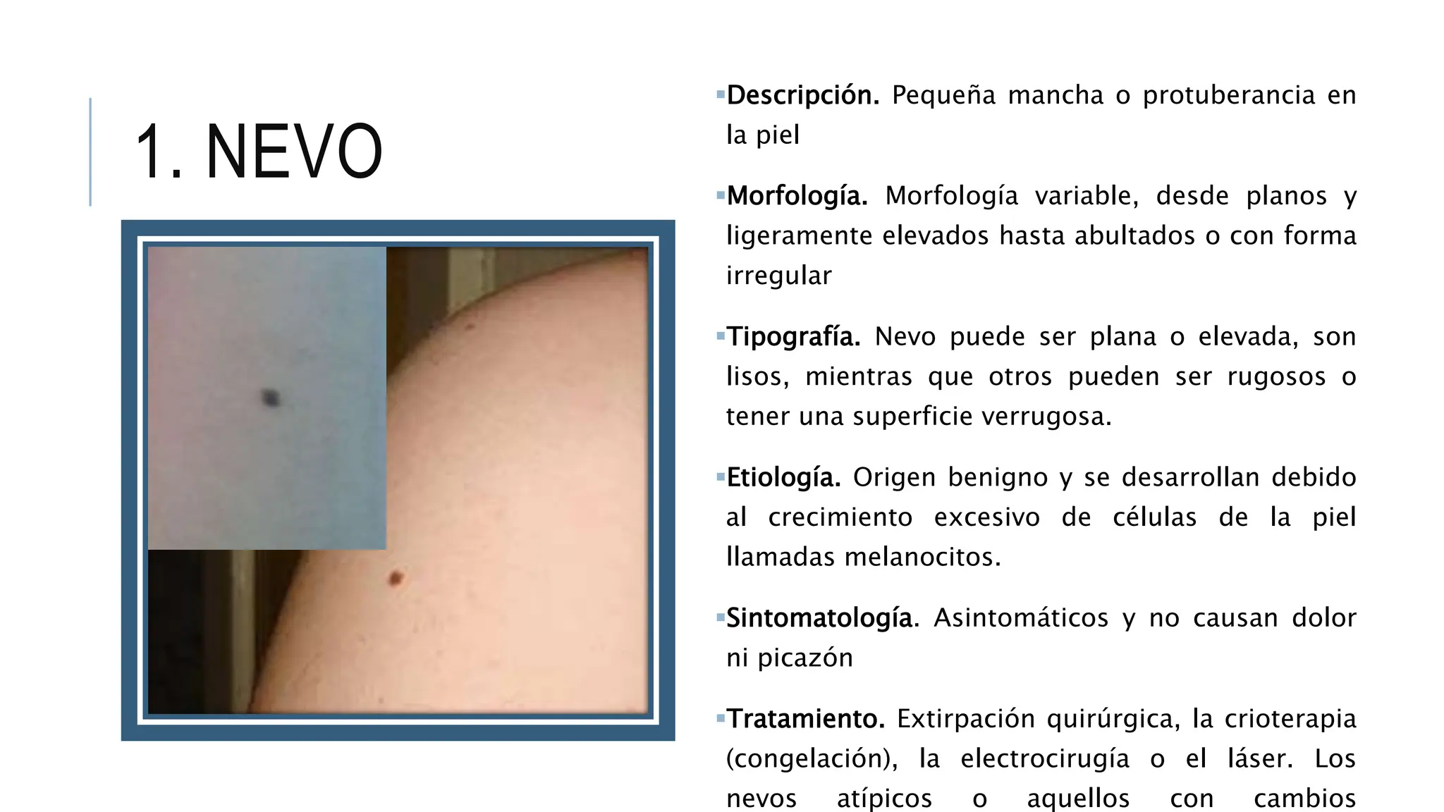ÀLBUM FOTOGRÀFICO DE DERMATOLOGÌA.pptx máculas, pápulas y otras ...