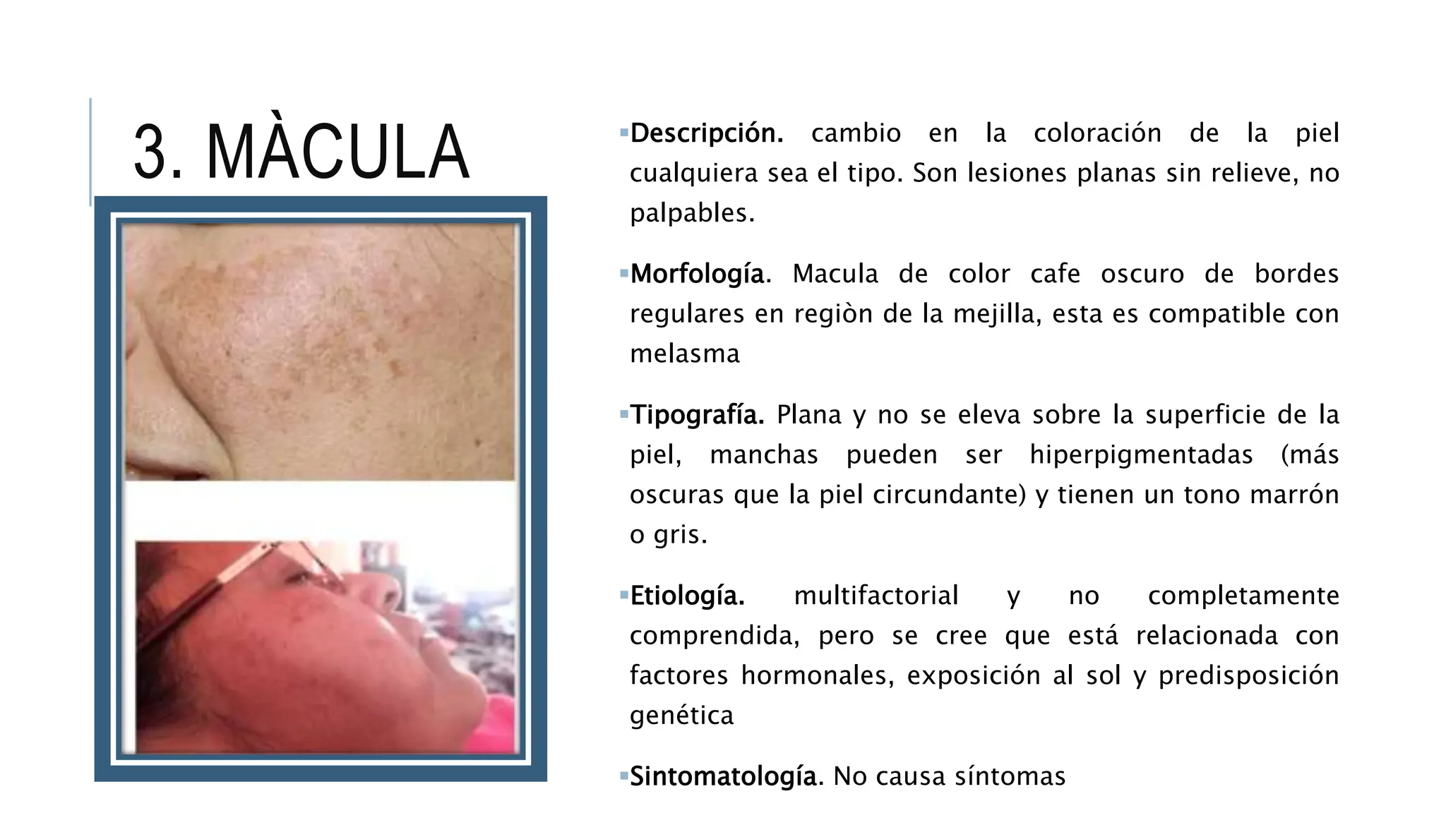 ÀLBUM FOTOGRÀFICO DE DERMATOLOGÌA.pptx máculas, pápulas y otras ...
