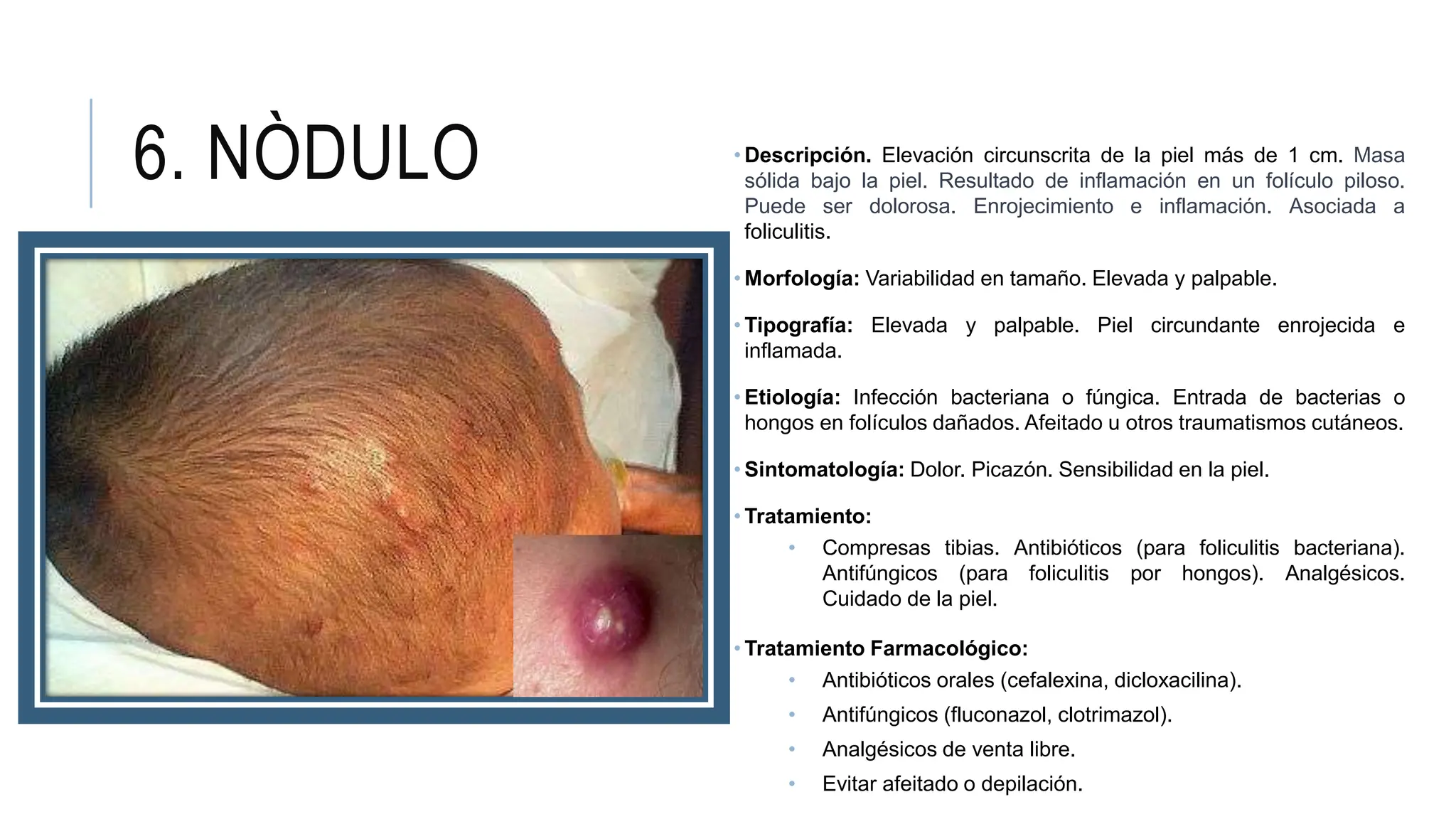 ÀLBUM FOTOGRÀFICO DE DERMATOLOGÌA.pptx máculas, pápulas y otras ...