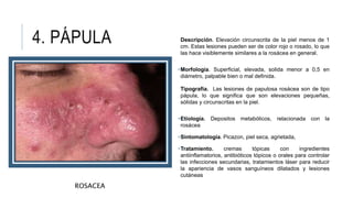 ÀLBUM FOTOGRÀFICO DE DERMATOLOGÌA.pptx máculas, pápulas y otras ...