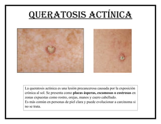 Álbum lesiones primarias y secundarias de la piel.docx