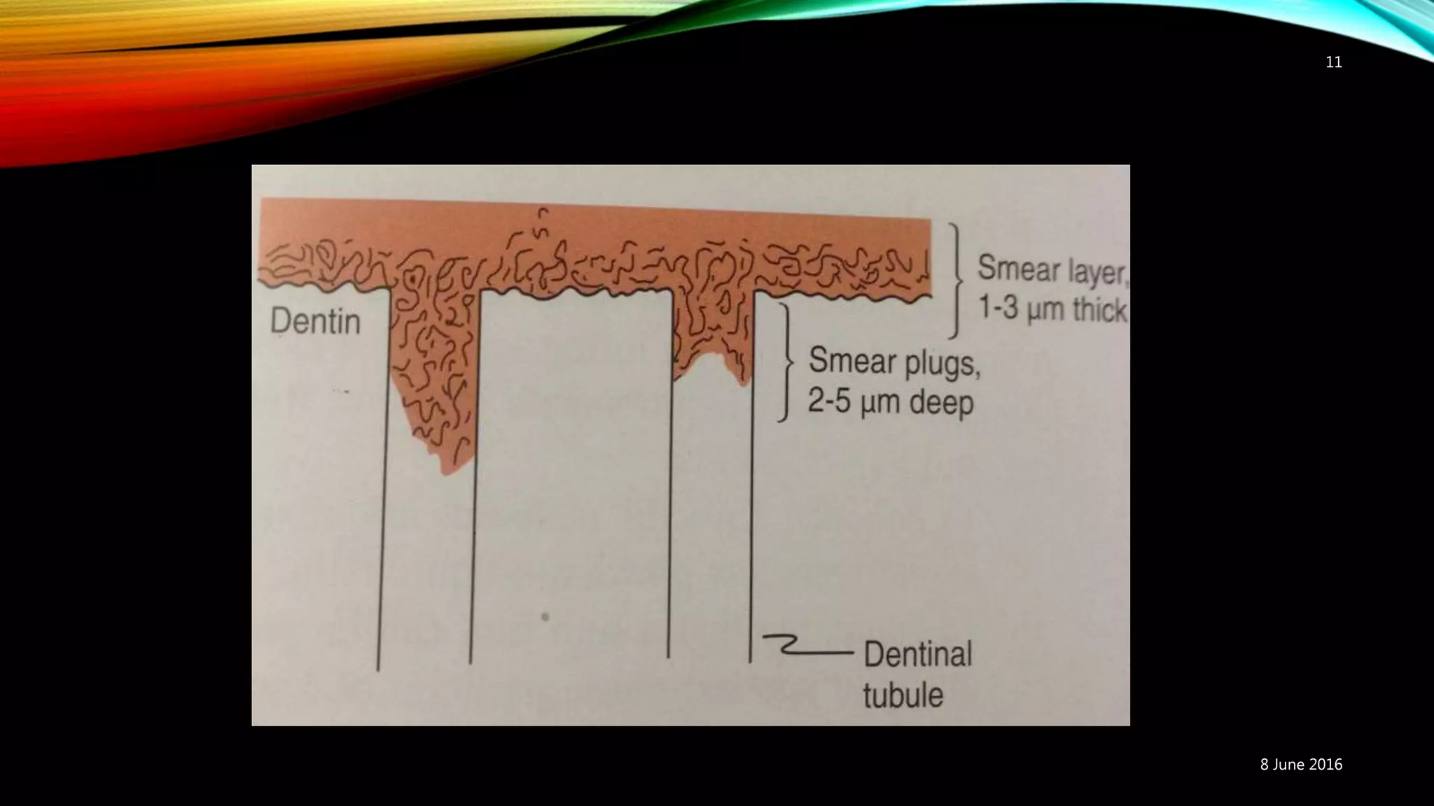 Liner Bases & Varnishes | PPTX | Dental Health | Diseases and Conditions