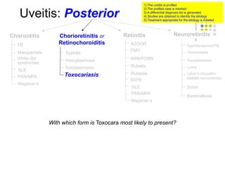 Uveitis ophthalmology anterior, posterior and pan | PPTX