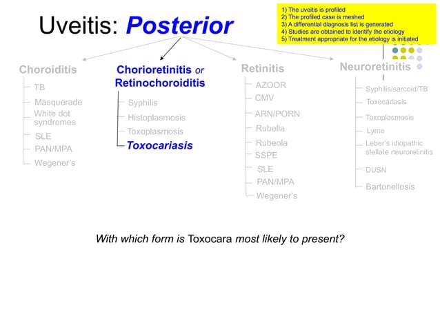 Uveitis ophthalmology anterior, posterior and pan | PPTX | Eye and ...