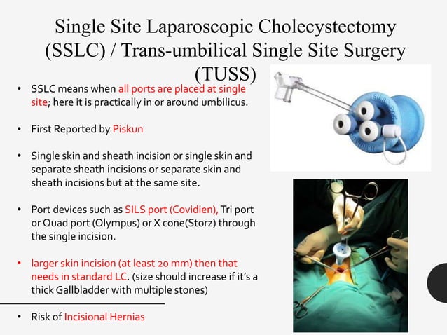 Laparoscopic Cholecystectomy | PPTX