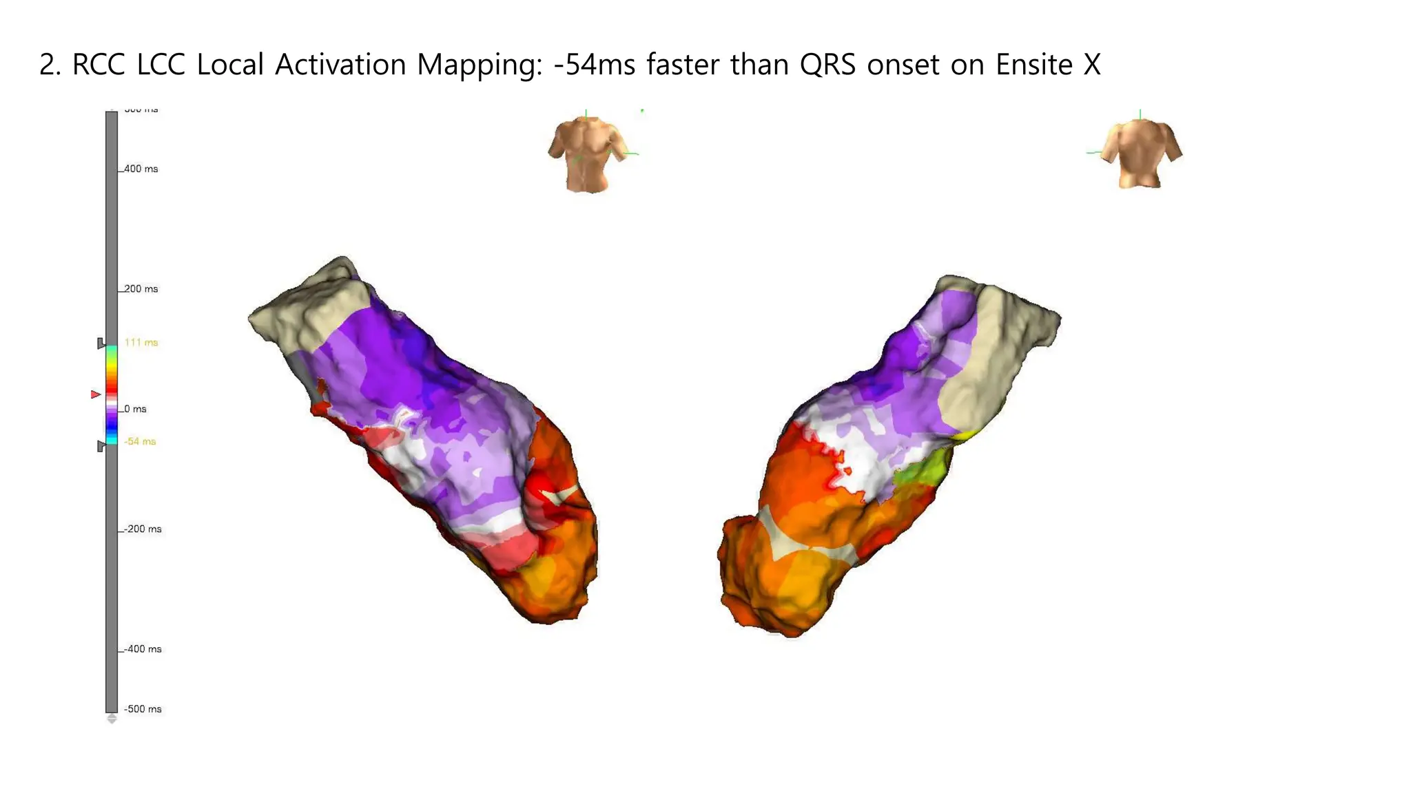 LCC PVC 자료_Abbott 나상규.pptx