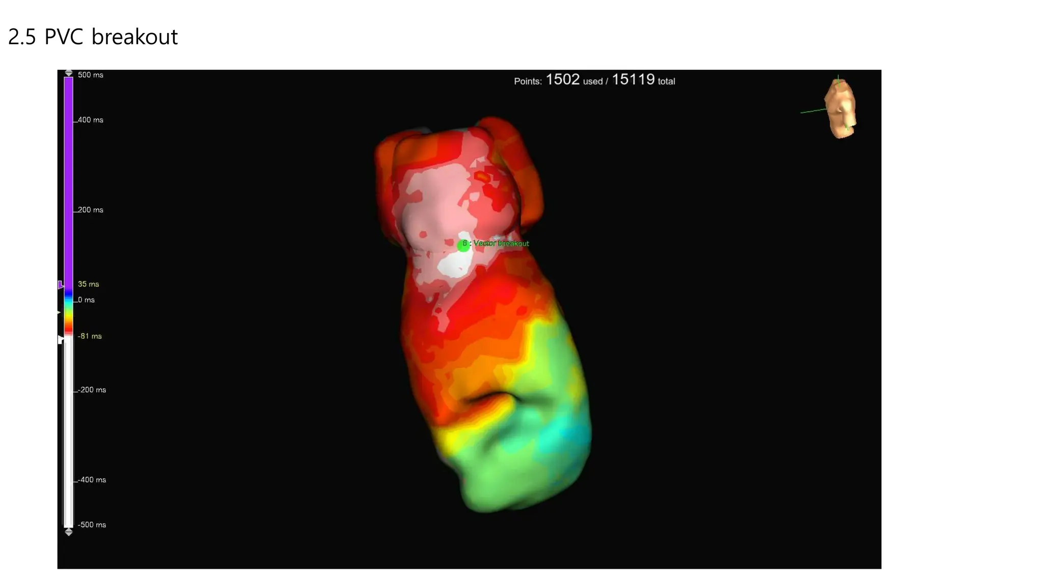 LCC PVC 자료_Abbott 나상규.pptx