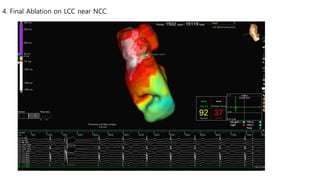 LCC PVC 자료_Abbott 나상규.pptx