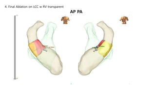 LCC PVC 자료_Abbott 나상규.pptx
