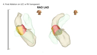 LCC PVC 자료_Abbott 나상규.pptx