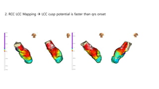 LCC PVC 자료_Abbott 나상규.pptx