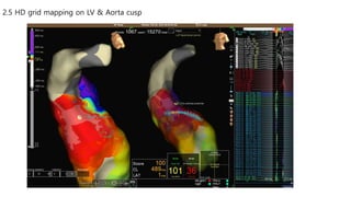 LCC PVC 자료_Abbott 나상규.pptx