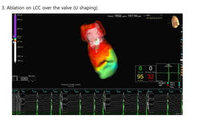 LCC PVC 자료_Abbott 나상규.pptx