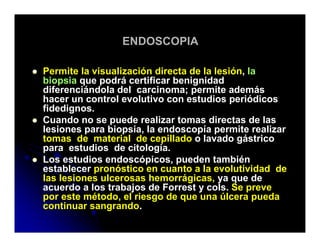Úlcera gastroduodenal generalidades 2024 | PDF