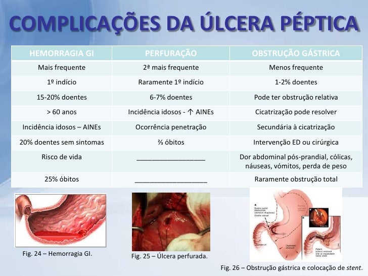 Úlcera Péptica: O Que É, Sintomas, Causas E Tratamento – ZGZM
