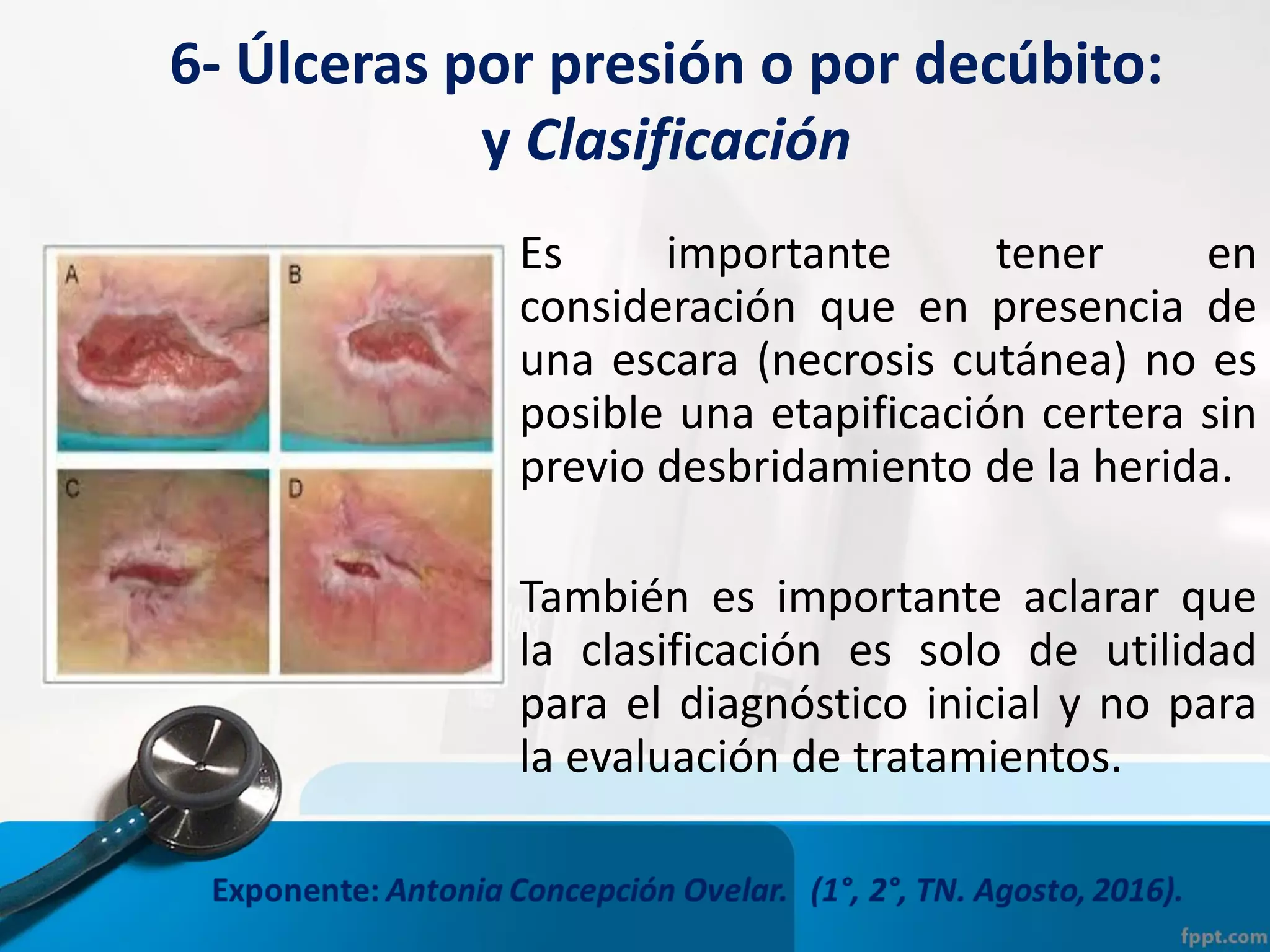 Úlceras por decúbito. Antonia Concepción Ovelar | PDF