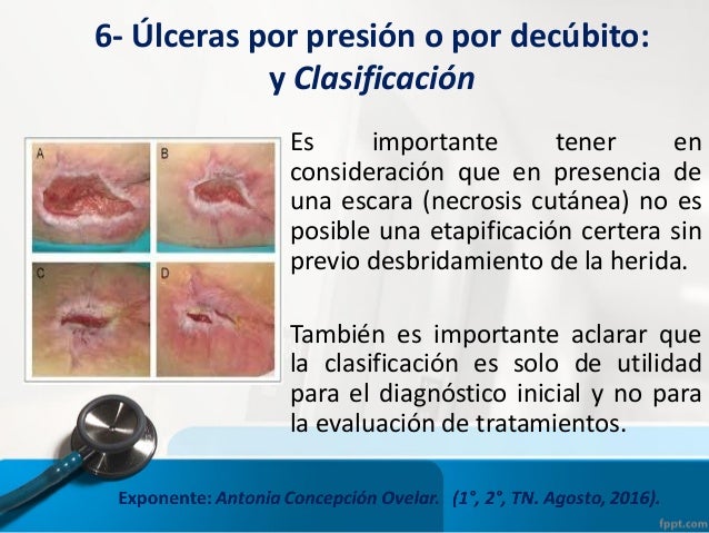Úlceras por decúbito. Antonia Concepción Ovelar