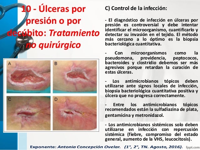 Úlceras por decúbito. Antonia Concepción Ovelar