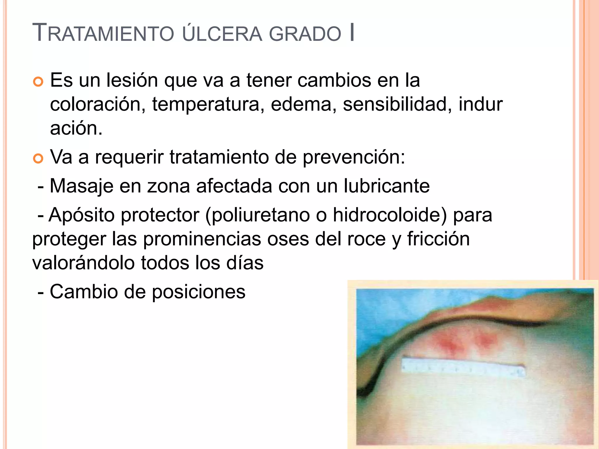 Úlceras por presión | PPTX