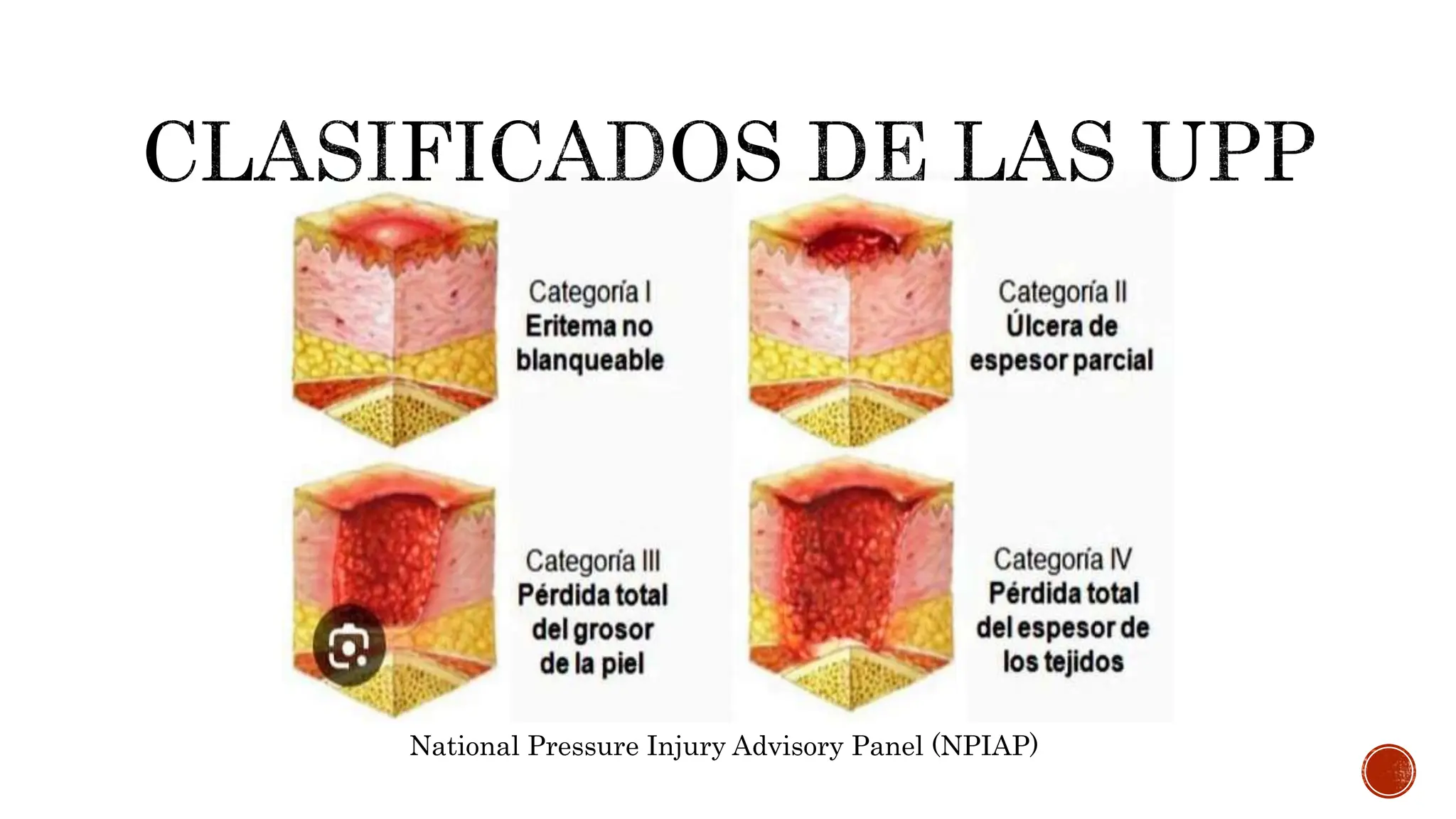 Úlceras por presión y clasificacion.pptx