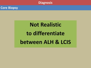 Lobular Carcinoma In Situ (LCIS) | PPTX