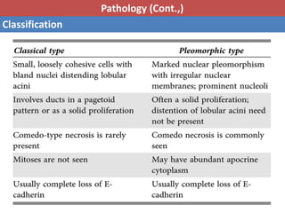 Lobular Carcinoma In Situ (LCIS) | PPTX