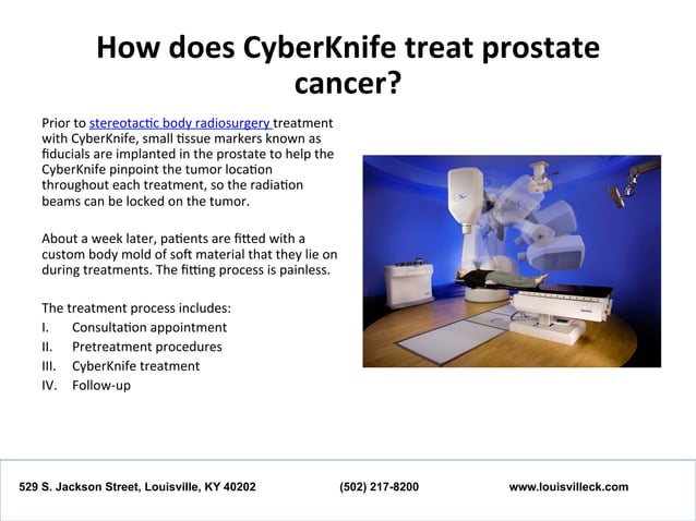 Prostate Cancer: CyberKnife® Treatment Overview | PDF