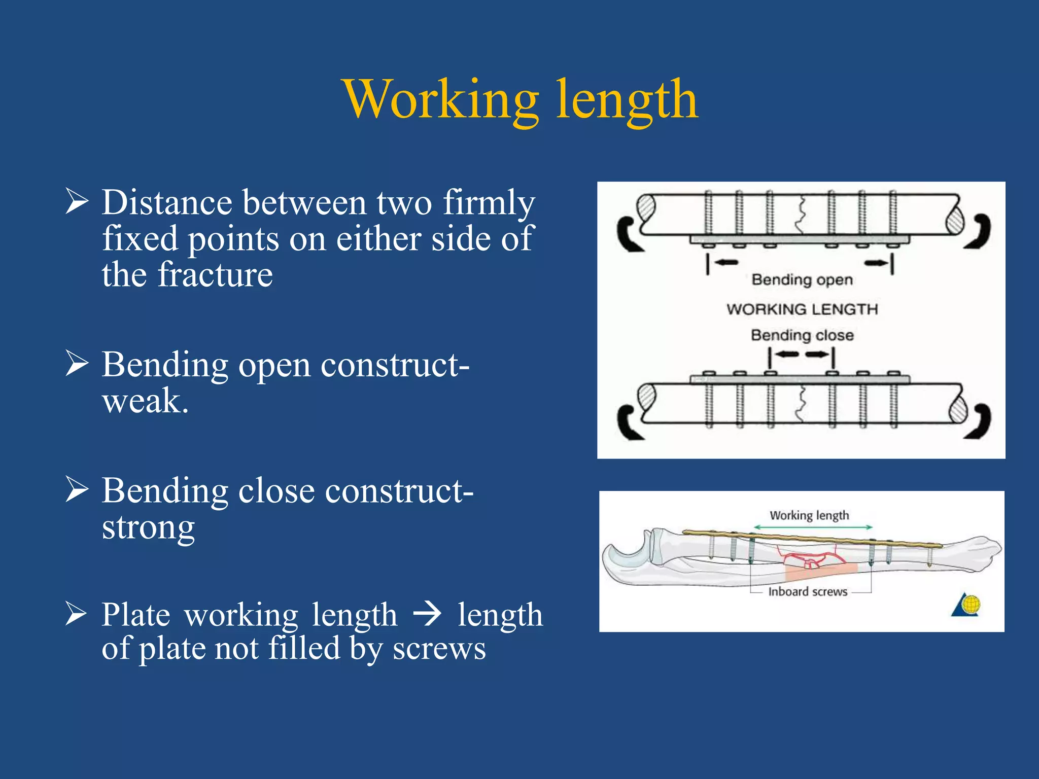 Lcp configuration, indication, advantages and biomechanics | PPTX