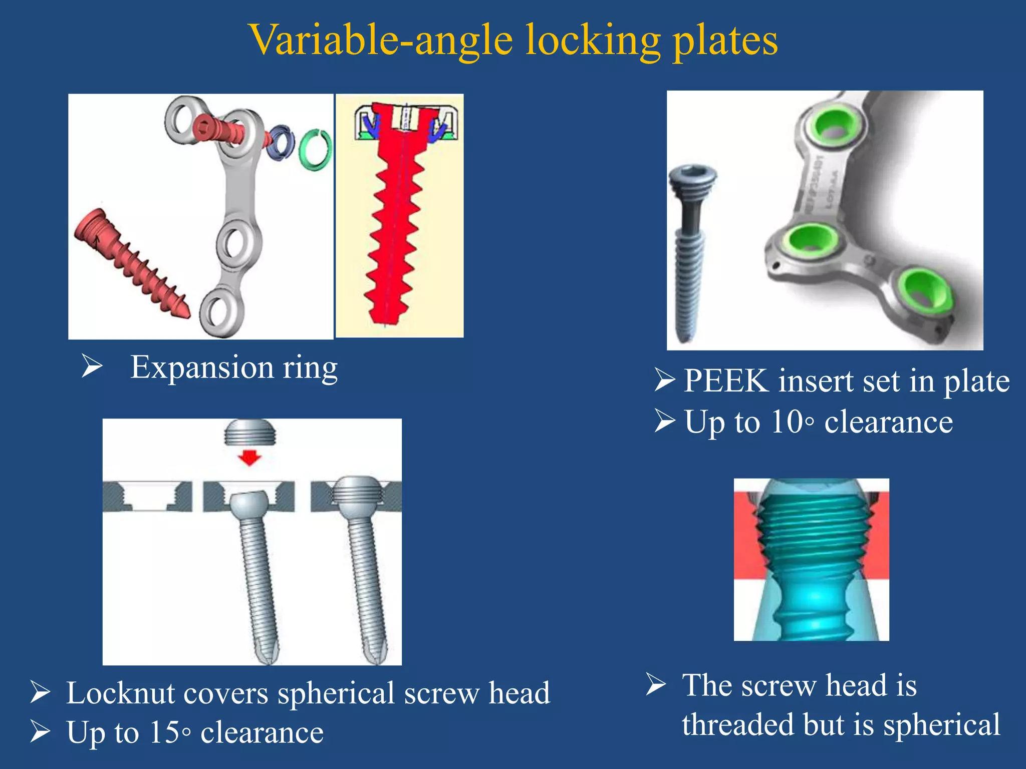 Lcp configuration, indication, advantages and biomechanics | PPTX