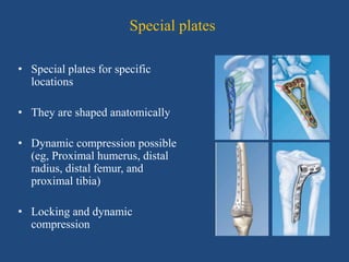 Lcp configuration, indication, advantages and biomechanics | PPT