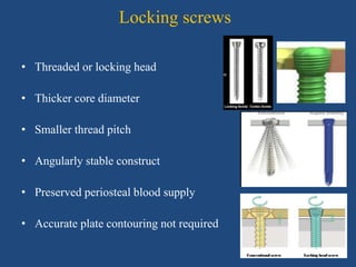 Lcp configuration, indication, advantages and biomechanics | PPT