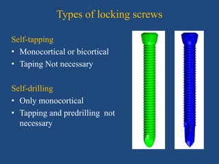 Lcp configuration, indication, advantages and biomechanics | PPTX