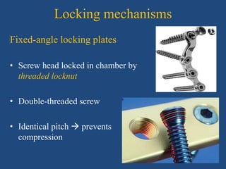 Lcp configuration, indication, advantages and biomechanics | PPT