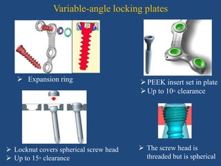 Lcp configuration, indication, advantages and biomechanics | PPTX