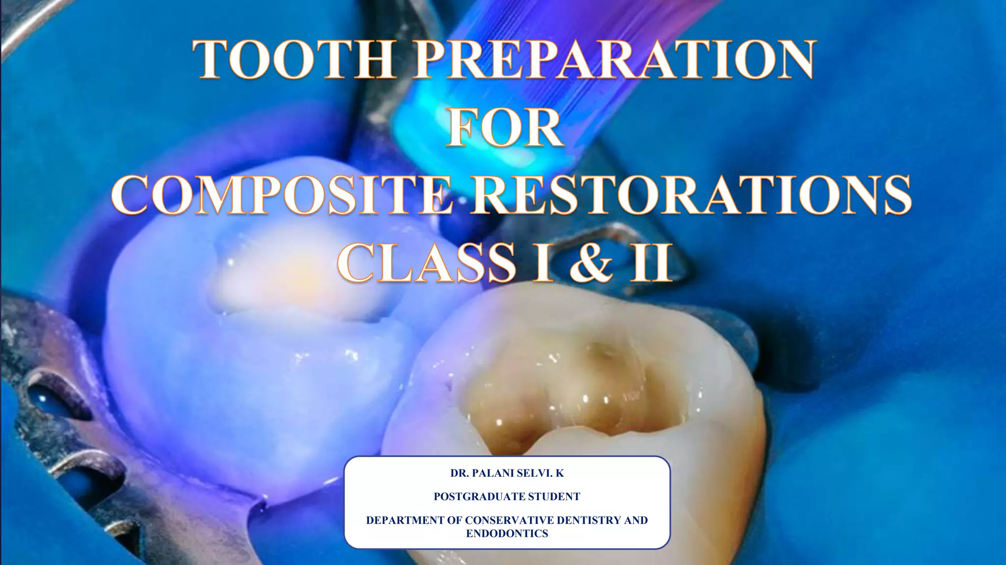Tooth Preparation Techniques for Restorations | PPT