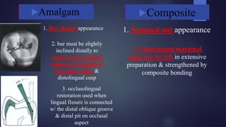 Class I , II Composites Cavity preparations | PPTX