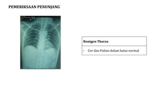 Laporan kasus tindakan digital substraction angiografi.pptx