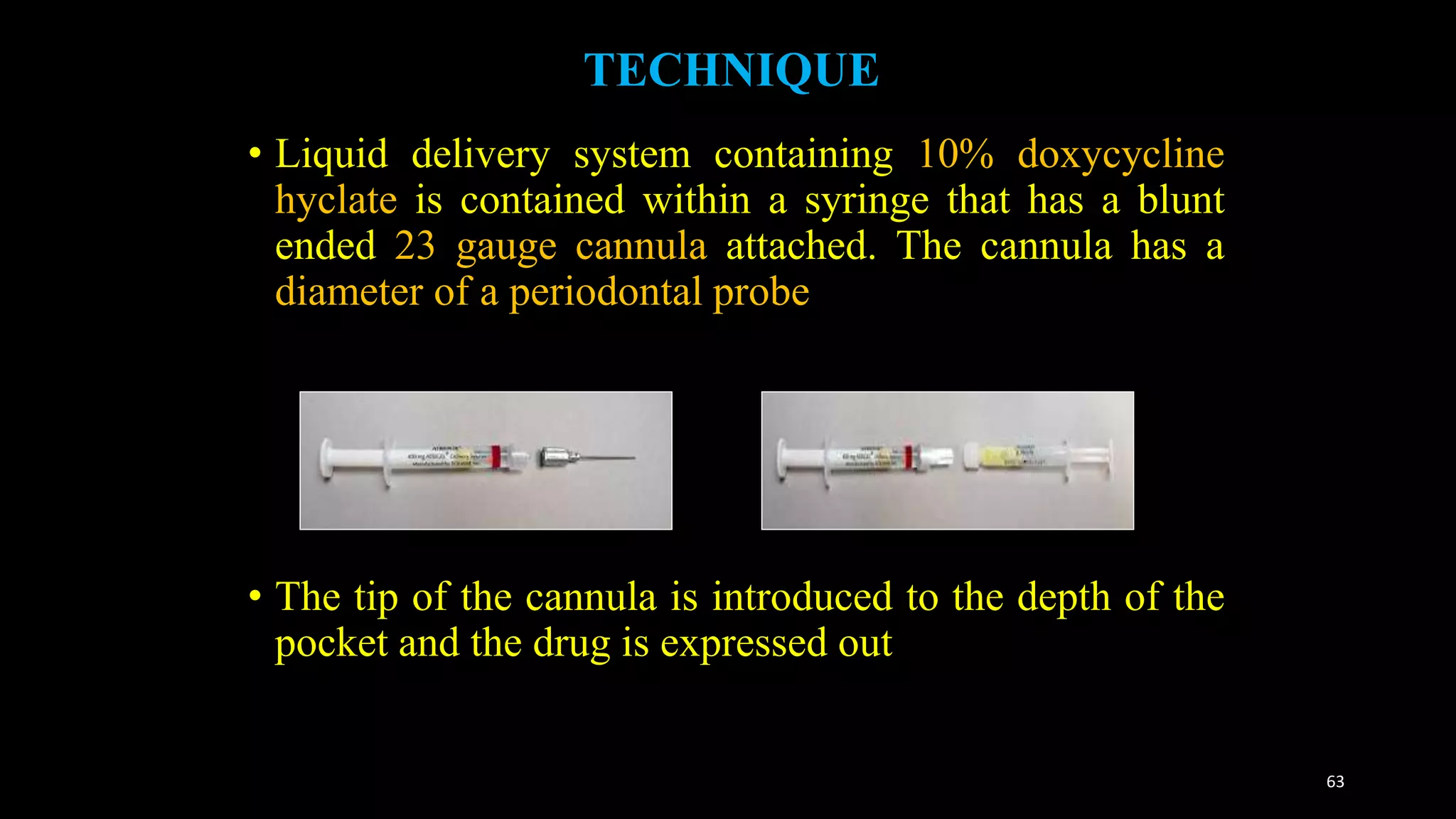 local drug delivery in periodontics | PPTX