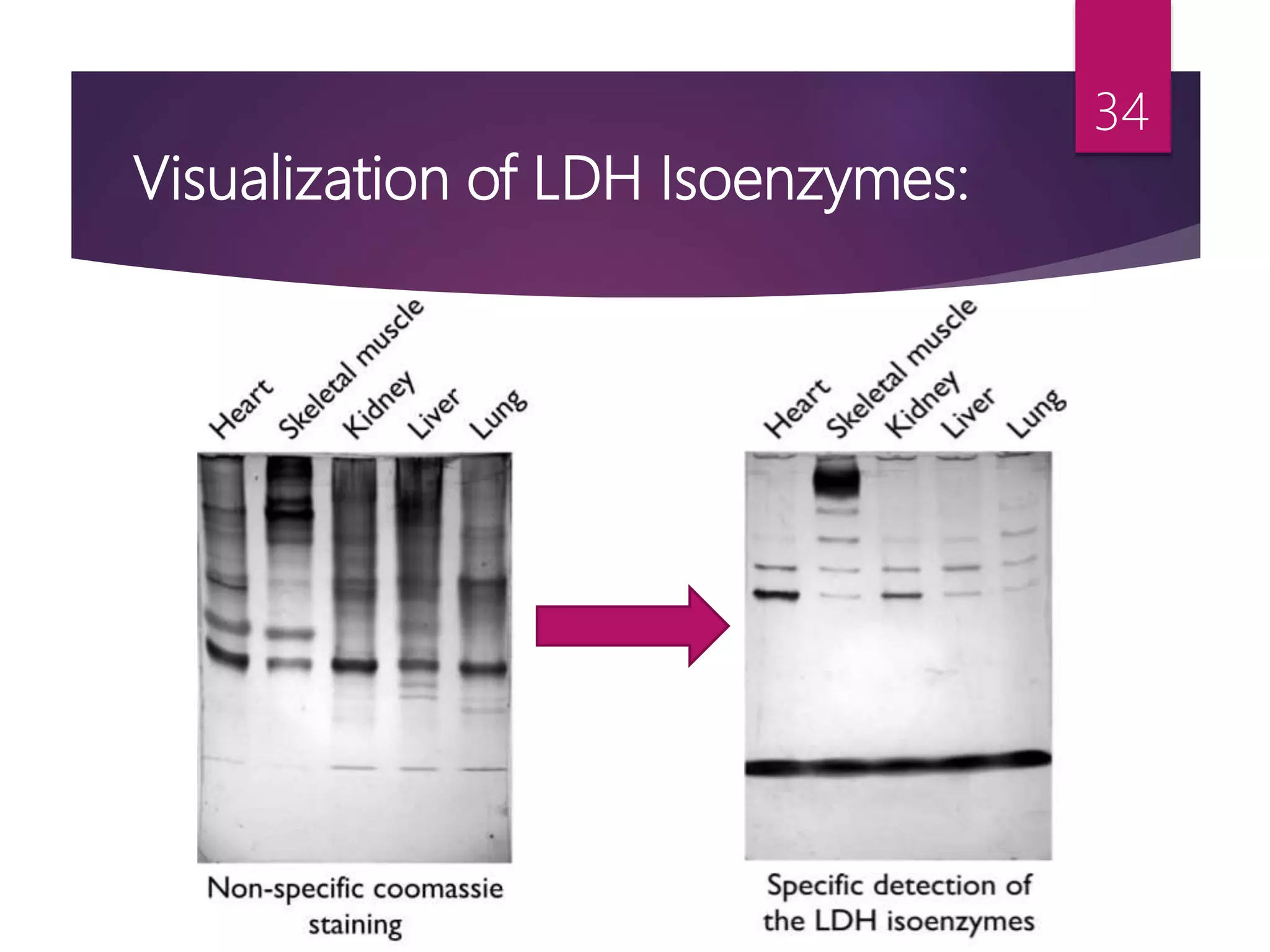 Electrophoresis of LDH Isoenzymes and Activity Staining | PPT