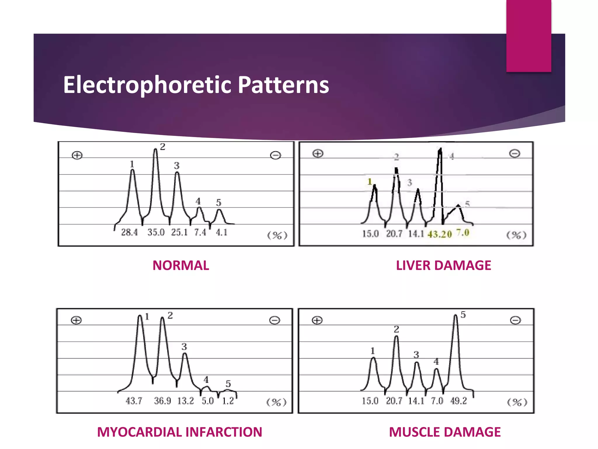 Electrophoresis of LDH Isoenzymes and Activity Staining | PPTX