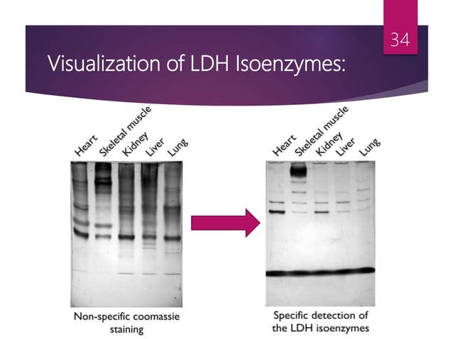 Electrophoresis of LDH Isoenzymes and Activity Staining | PPTX