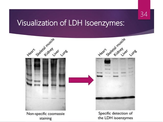 Electrophoresis of LDH Isoenzymes and Activity Staining