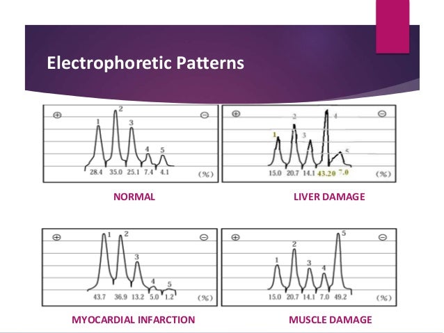 Electrophoresis of LDH Isoenzymes and Activity Staining